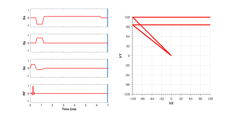 k-Space without Math — How MRI Really Works documentation
