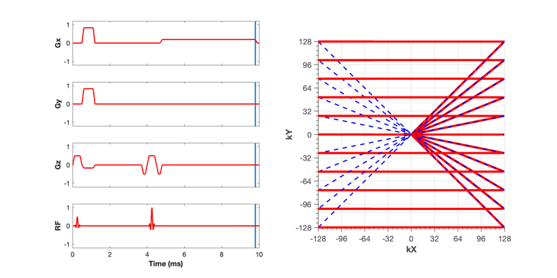 k-Space without Math — How MRI Really Works documentation
