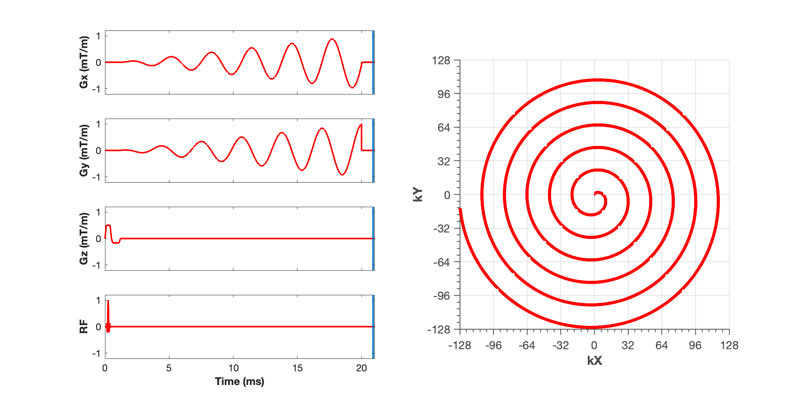 k-Space without Math — How MRI Really Works documentation